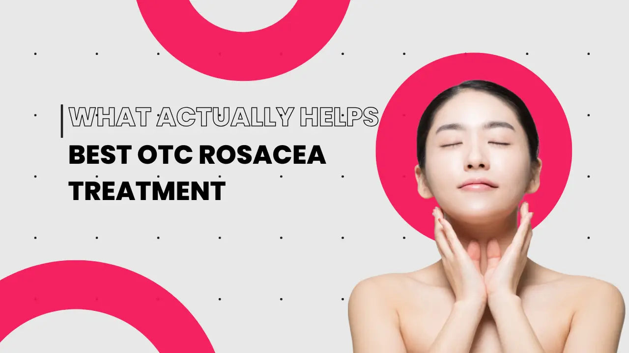 Best OTC Rosacea Treatment: What Actually Helps - The Korean Style